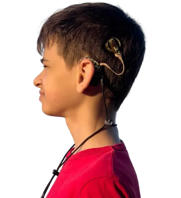 Ear Hearing Aids & Tests - Cochlear Implant Device Cost in Lahore